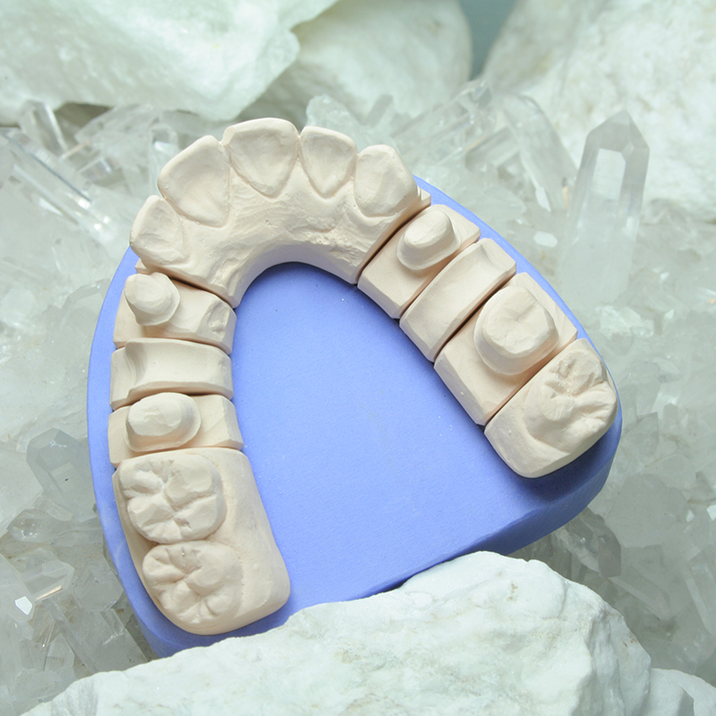 Dental Die Stone at Milla Gadsdon blog